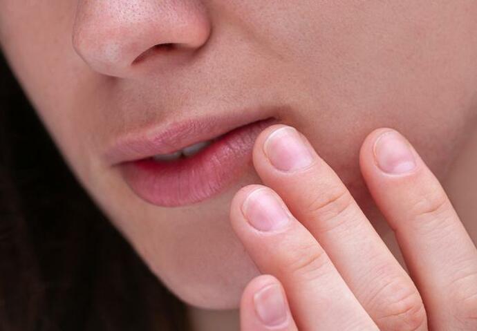 10 astuces pour soigner rapidement un bouton de fièvre